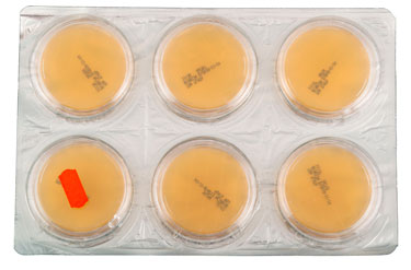 Sabouraud Chloramphenicol Modified Agar . Contact Plates. - Scharlab