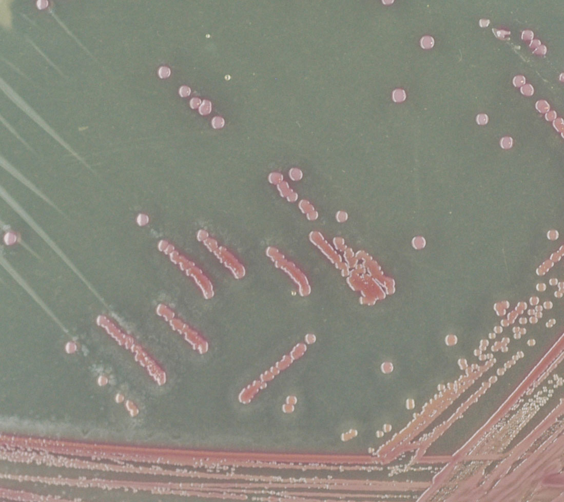 CHROMagar MRSA. Medio de cultivo cromogénico para la detección y de S ...