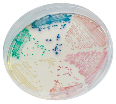 Medios cromogénicos CHROMagar™ | Scharlab