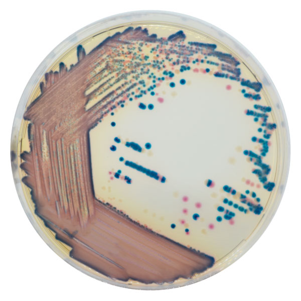 Medios cromogénicos CHROMagar™ | Scharlab