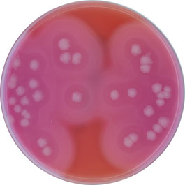Bacillus cereus, Agar Base - Scharlab