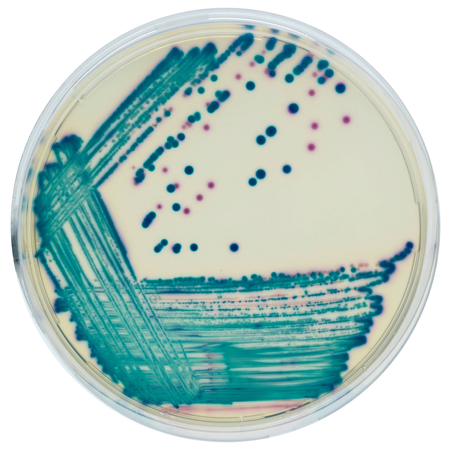 Chromogenic media CHROMagar™ | Scharlab