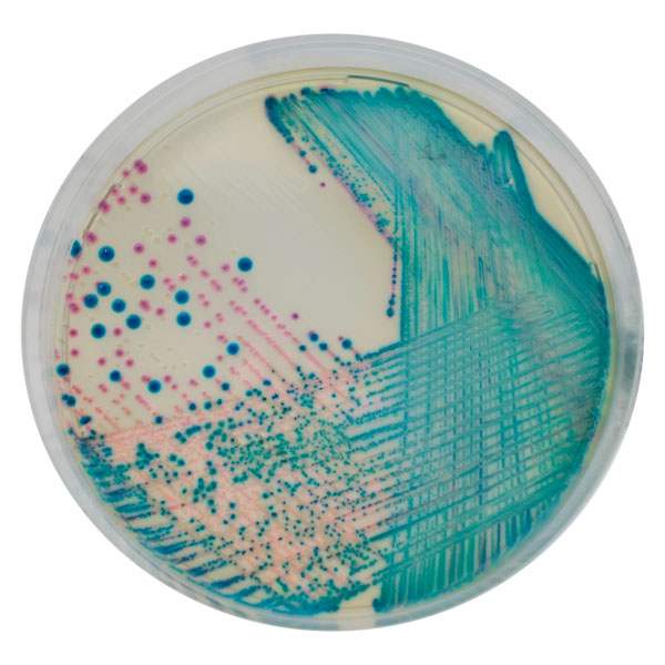 Chromogenic media CHROMagar™ | Scharlab