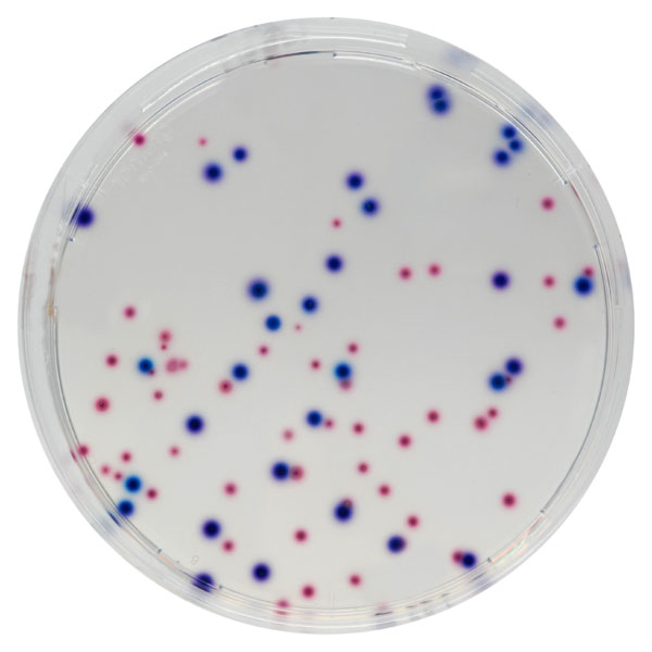 Medios cromogénicos CHROMagar™ | Scharlab
