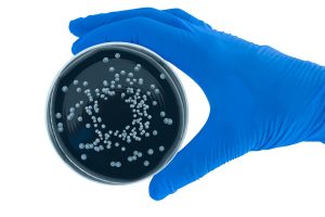 Controllo della legionella secondo la norma ISO 11731:2017 - Scharlab ...